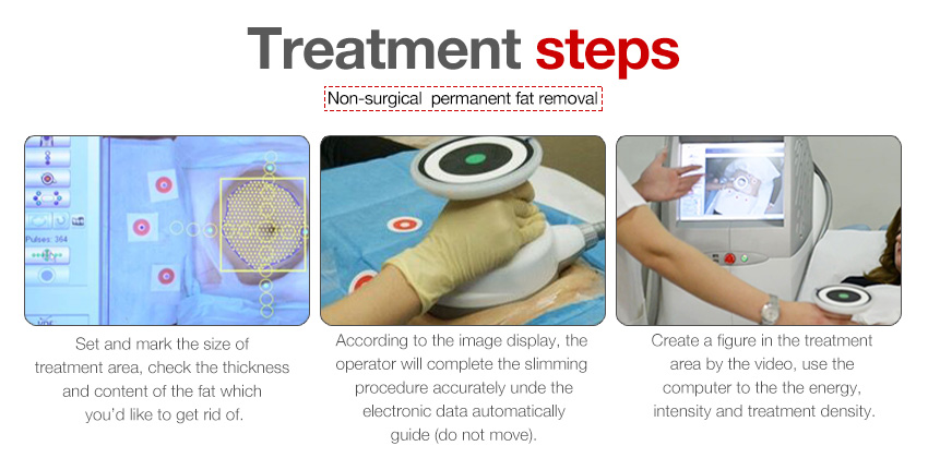 Ultrashape therapy belly 3D accuratent control fat burning USV3